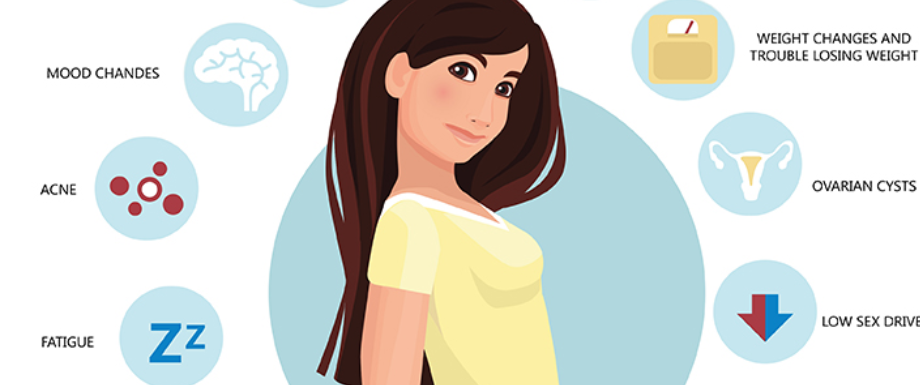 What are the symptoms of PCOS?